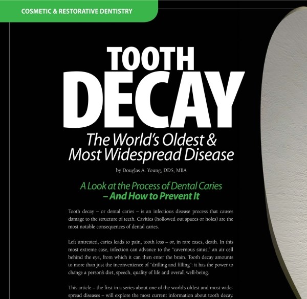 Tooth Decay Prevention | Chadds Ford Dental Tips